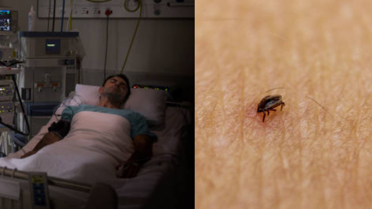 ajab gajab man reported typhus in body due to flea bite also losing ...