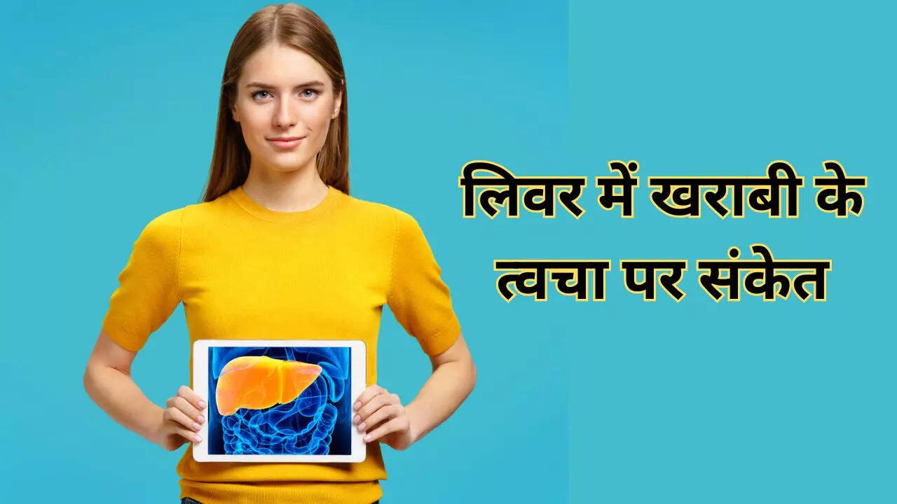 त्वचा पर दिखें ये लक्षण तो खतरे में आपका लिवर, दिखते ही तुरंत करें ये ...