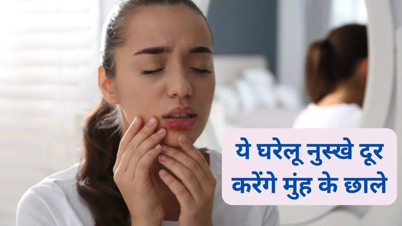 मुंह के छालों ने कर दिया खाना-पीना मुश्किल तो तुरंत अपनाएं ये घरेलू ...