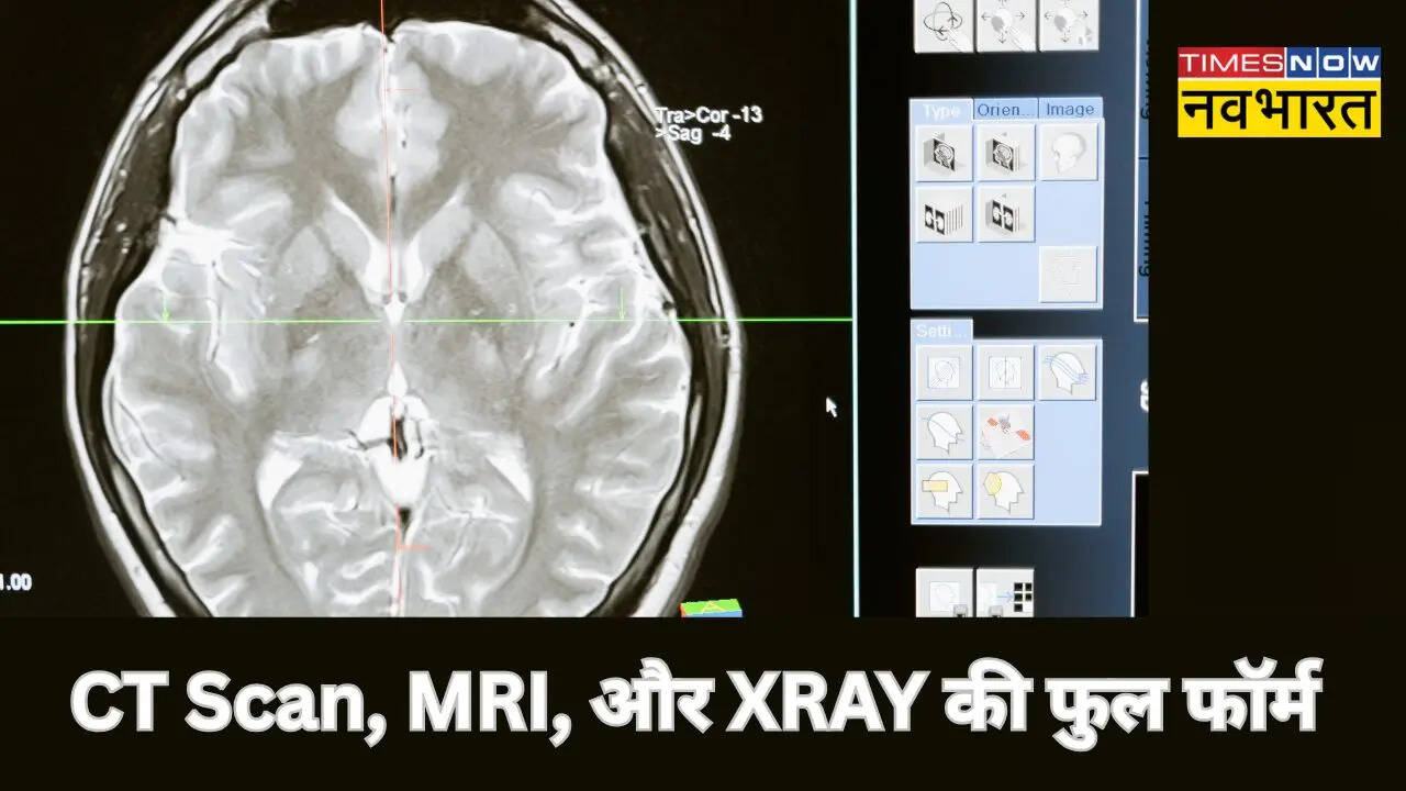 क्या होती है CT Scan, MRI और XRay की फुल फॉर्म ? अच्छे-अच्छों को नहीं ...