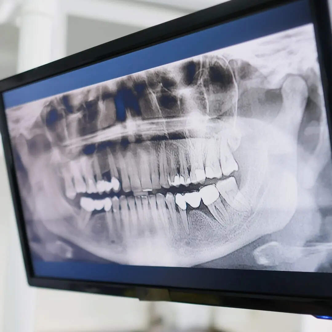 क्या होती है CT Scan, MRI और XRay की फुल फॉर्म ? अच्छे-अच्छों को नहीं ...