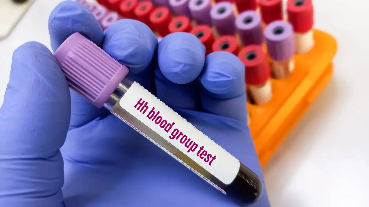 What is Bombay Blood Group Rarest Blood Type Discovery History and ...