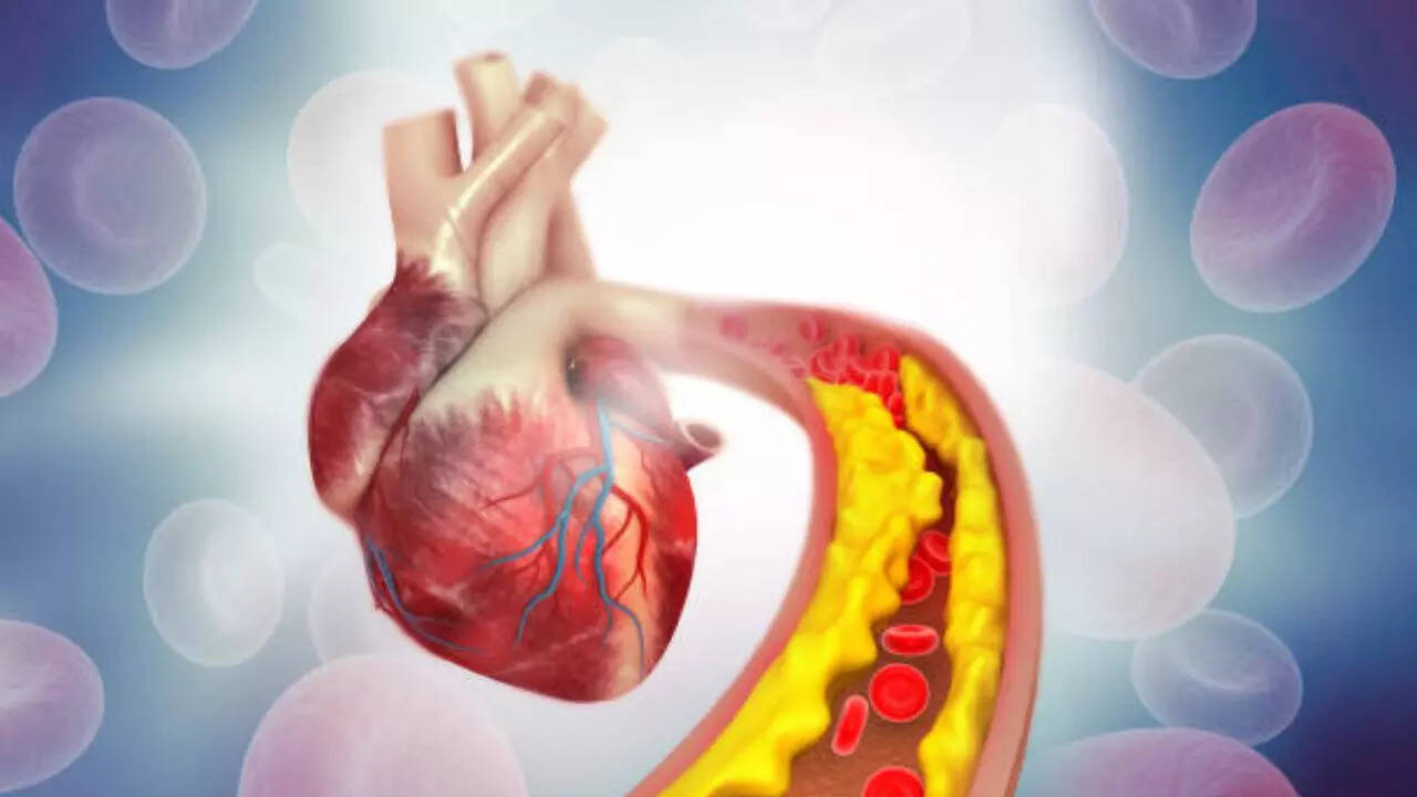 How does LDL Cholesterol increase? Know how much cholesterol should be ...