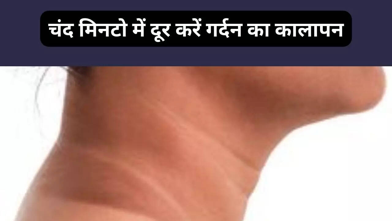 How get rid dark Neck Overnight In 20 Minutes, Home Remedies For Dark ...